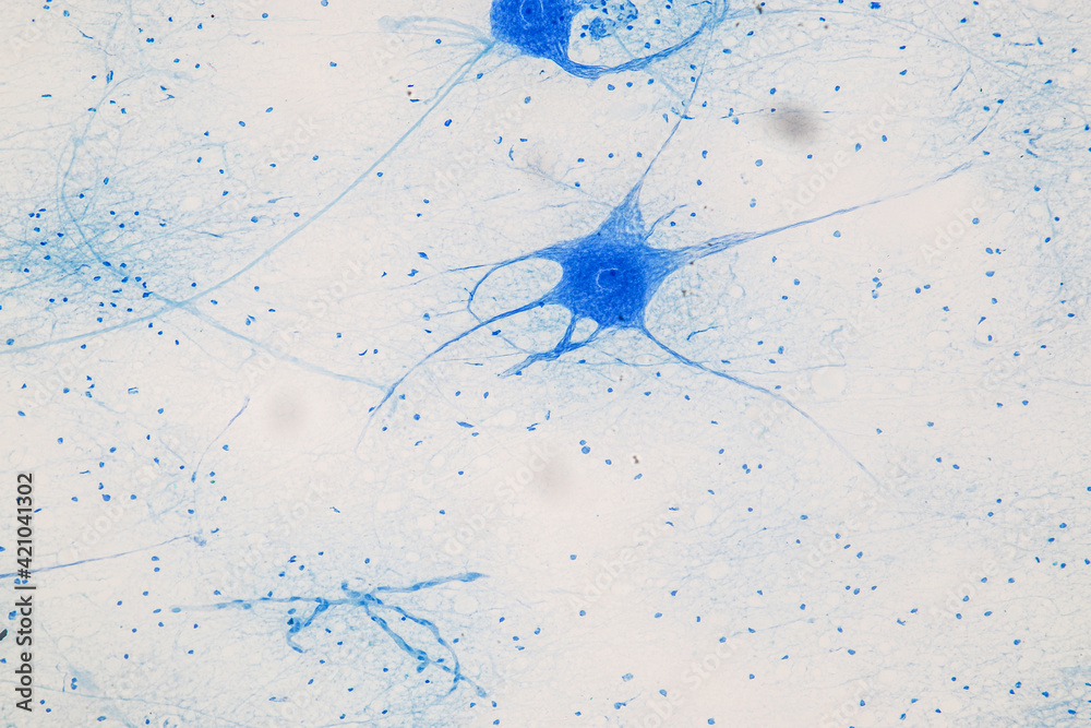 Education Spinal cord, Nerve, Cerebellum, Cortex and Motor Neuron Human ...