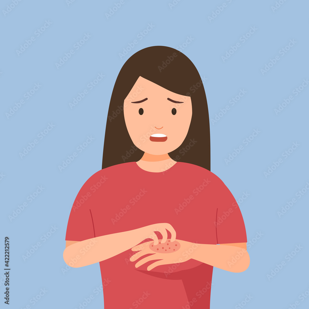 Young woman scratching hand suffering strong allergy skin itchy symptom ...
