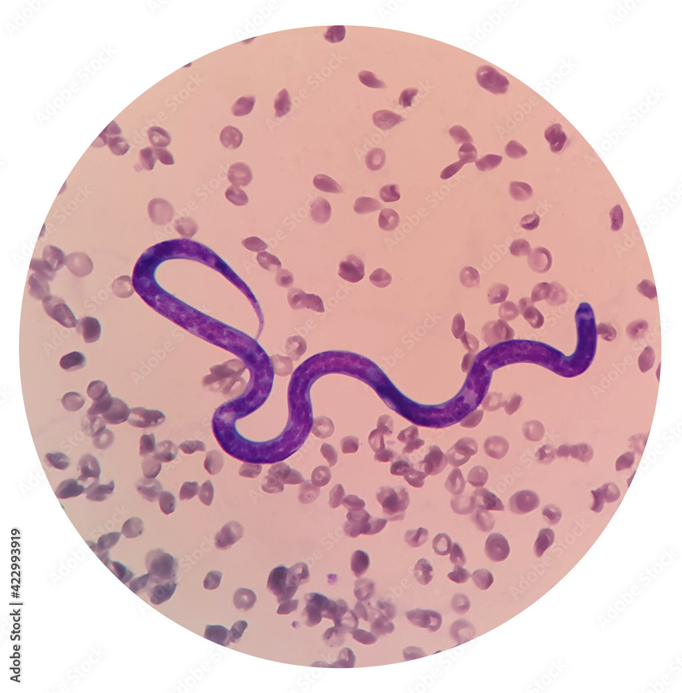 Microfilariae are not sheathed in the blood smear of a dog. Light ...