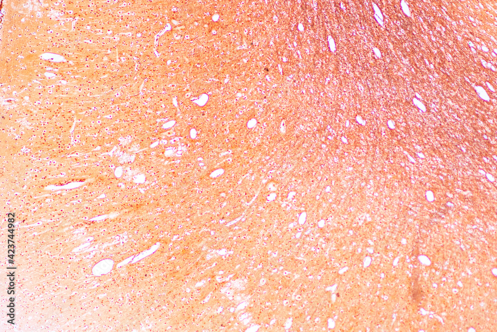 Education Spinal cord, Nerve, Cerebellum, Cortex and Motor Neuron Human ...