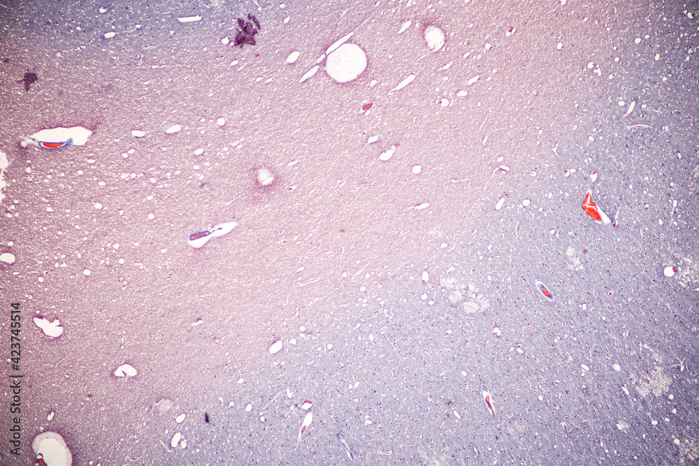 Education Spinal cord, Nerve, Cerebellum, Cortex and Motor Neuron Human ...