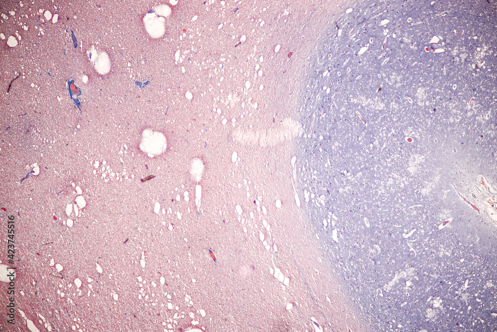 Foto de Stock Education Spinal cord, Nerve, Cerebellum, Cortex and ...