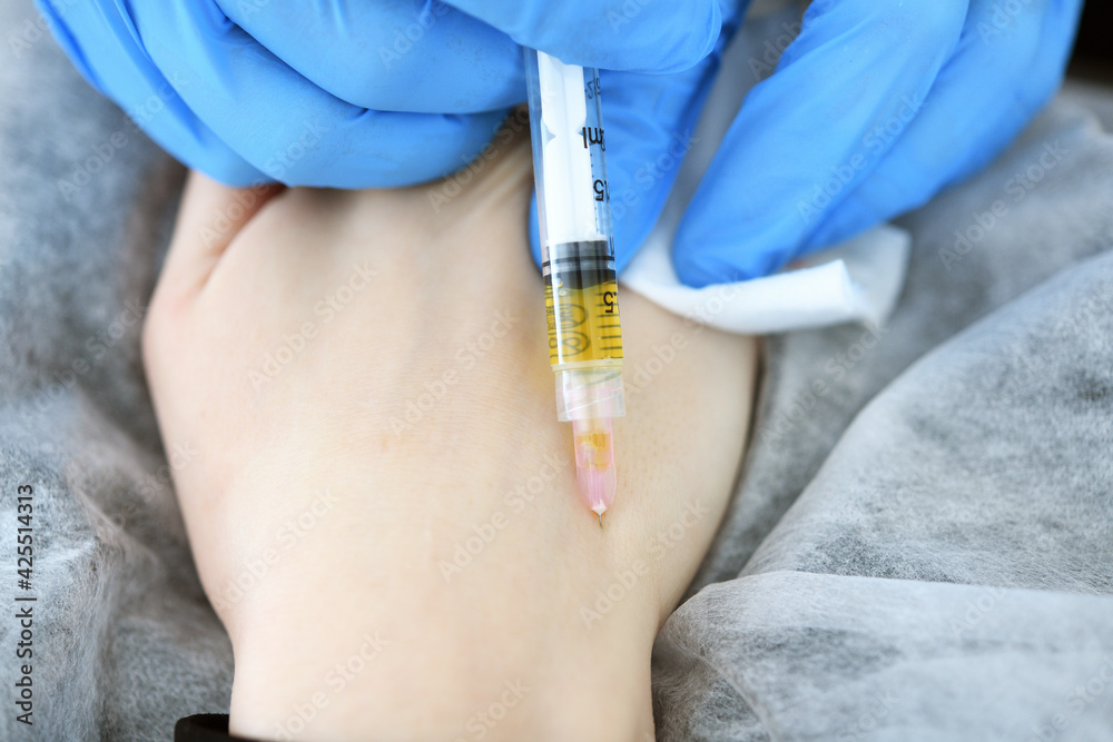 A plastic surgeon doctor does an injection of a beauty injection into ...