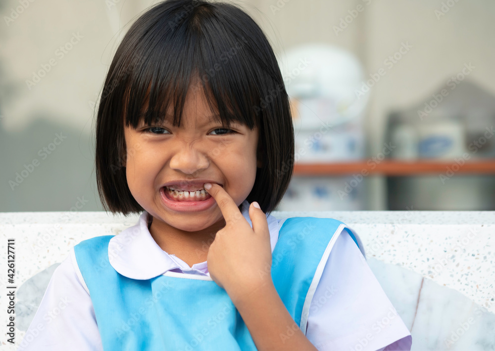 child open mouth to showing caries teeth decay, signs of tooth decay ...