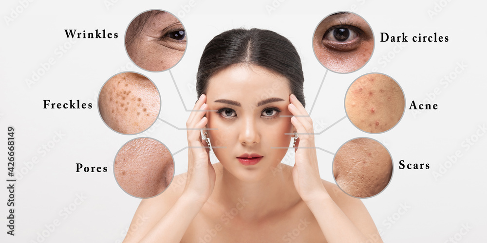 Asian woman with facial skin problems. Young female anxious about face ...