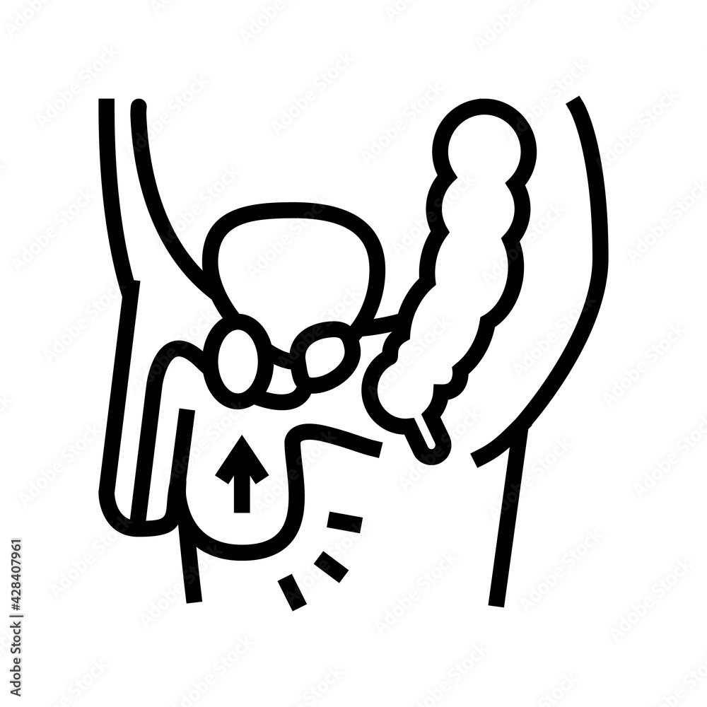 cryptorchidism disease line icon vector. cryptorchidism disease sign ...