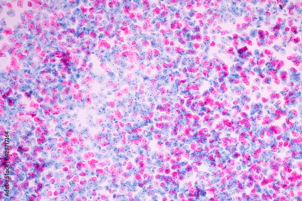 Normal squamous epithelial cells of cervical human view in microscopy ...