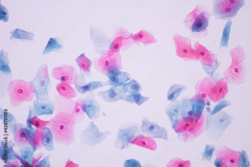 Normal squamous epithelial cells of cervical human view in microscopy ...