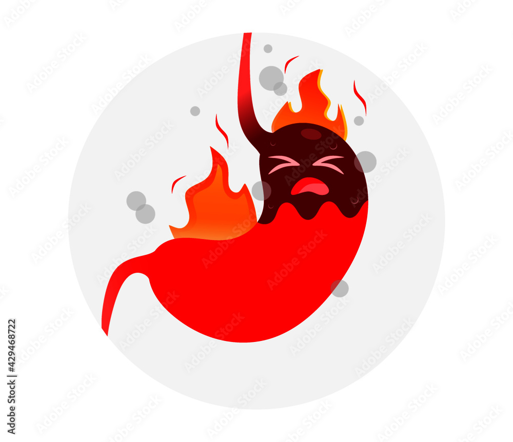 Cartoon stomach suffering acid reflux. Burning like a fire from ...