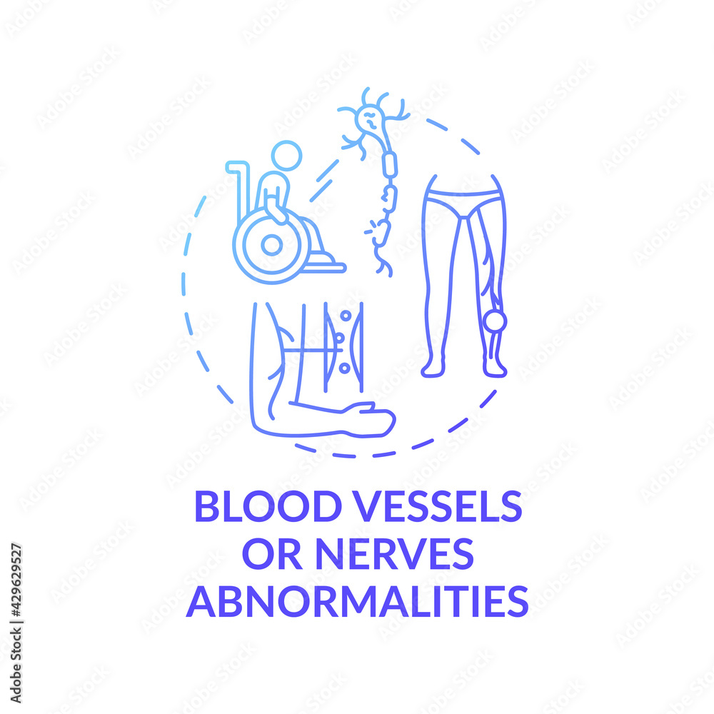 Blood vessels and nerves abnormalities concept icon. Amputation cause ...