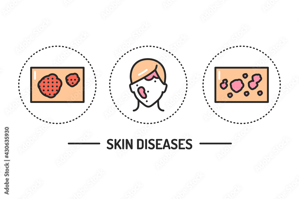 Skin diseases color line icons concept. Isolated vector element ...