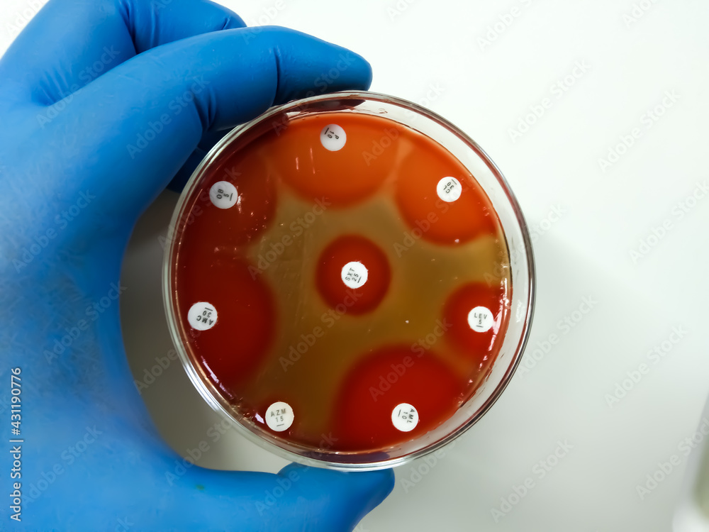 Foto de Stock Antimicrobial susceptibility testing in petri dish ...