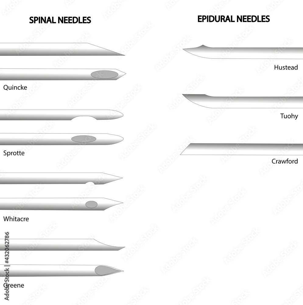 Spinal and Epidural Needle. Different types of spinal and epidural ...
