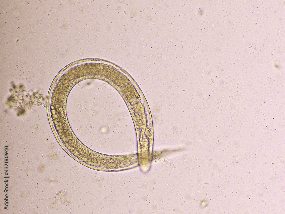 Strongyloides stercoralis or threadworm in human stool, analyze by ...