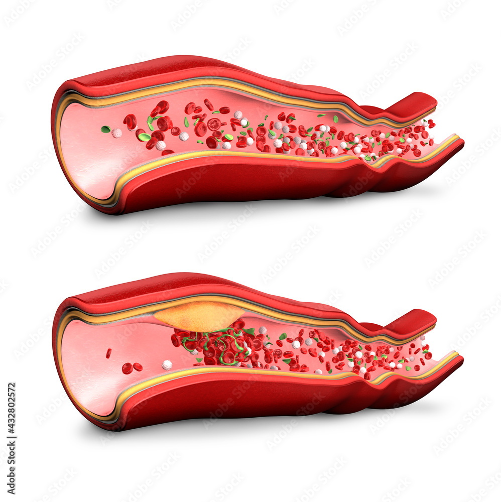 Bloodstream, red blood cells, white blood cells and platelets (green in ...