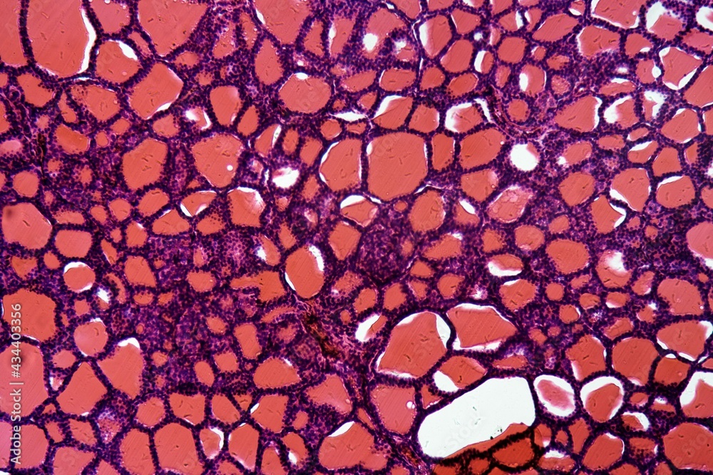 Thyroid gland cells under the microscope Stock Photo | Adobe Stock
