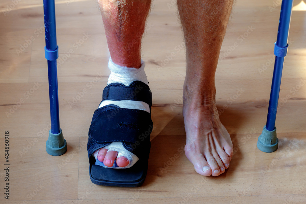 Foot surgery, Plaster or pressure bandage wrapped feet after operation ...