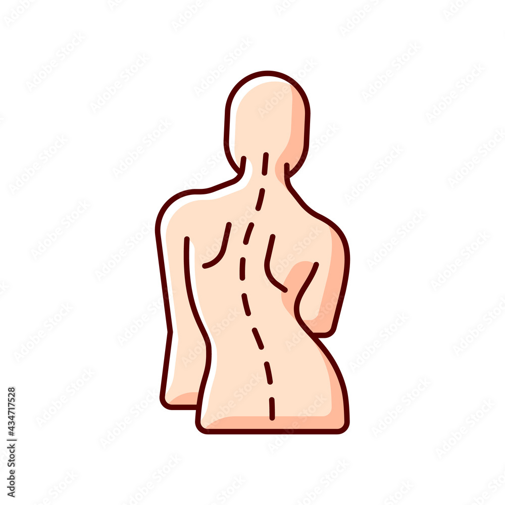 Scoliosis RGB color icon. Sideways curve. Uneven hips and shoulders ...