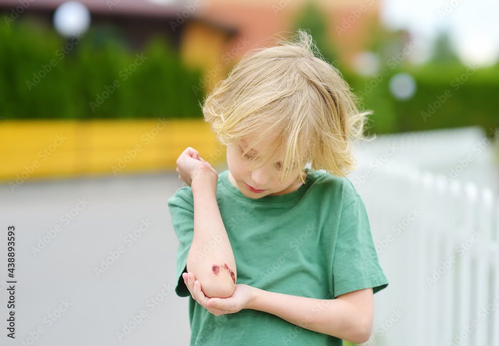 Cute little boy looking on his elbow with wound. Child healthcare and ...