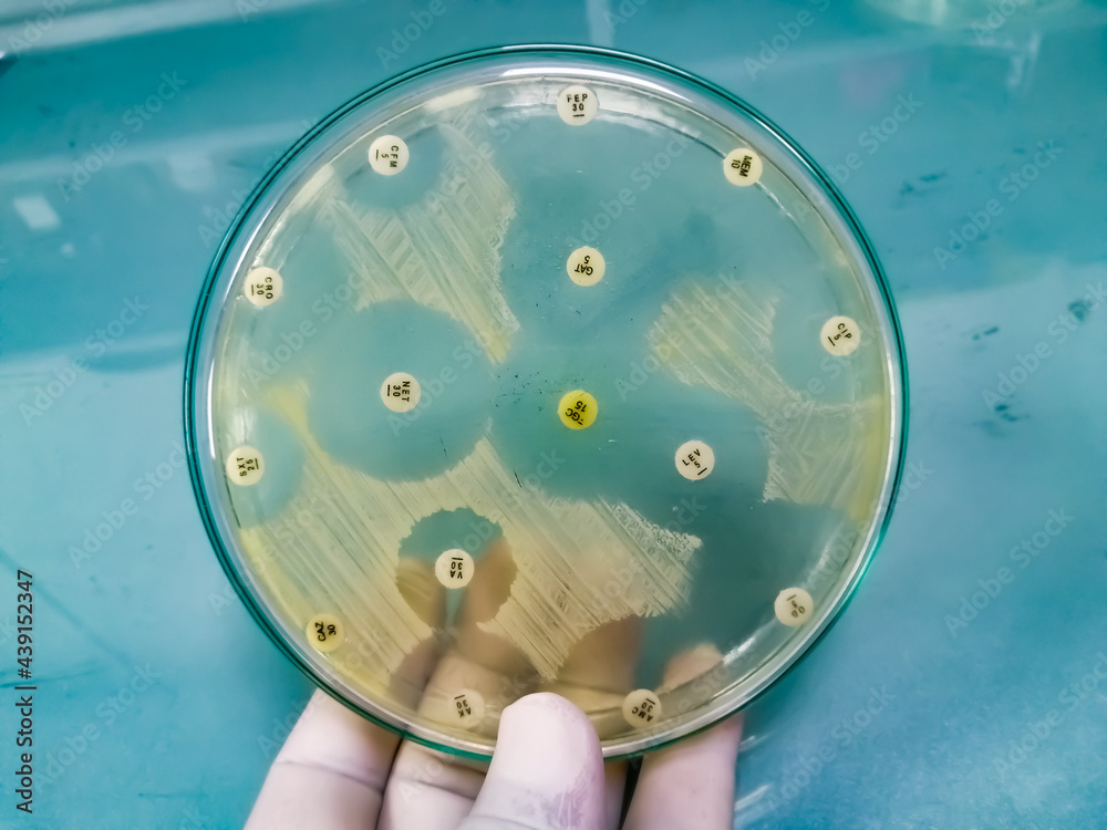 Antimicrobial susceptibility testing in petri dish with Muller Hinton ...