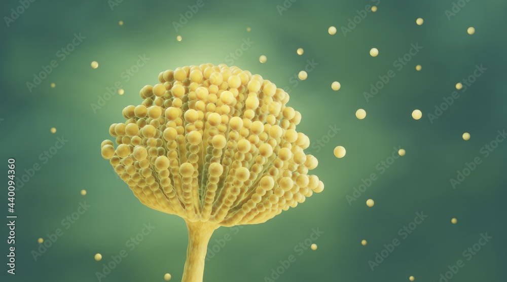 Fungal infection, Aspergillus is a mold fungi that can trigger ...