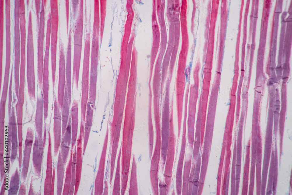 Characteristics of anatomy and Histological sample Striated (Skeletal ...