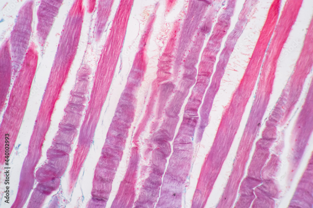 Characteristics of anatomy and Histological sample Striated (Skeletal ...