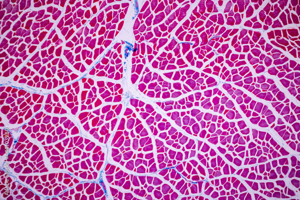 Characteristics of anatomy and Histological sample Striated (Skeletal ...