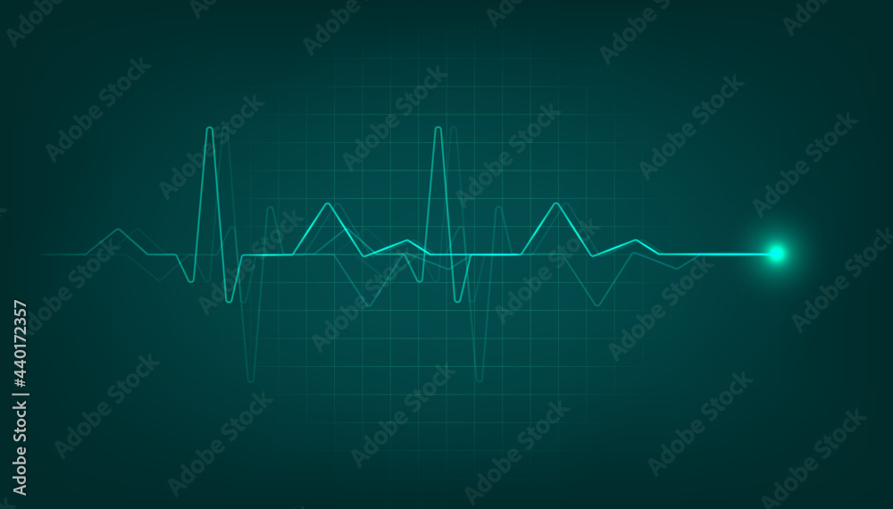 Green heart pulse monitor with signal. Heart beat cardiogram background ...
