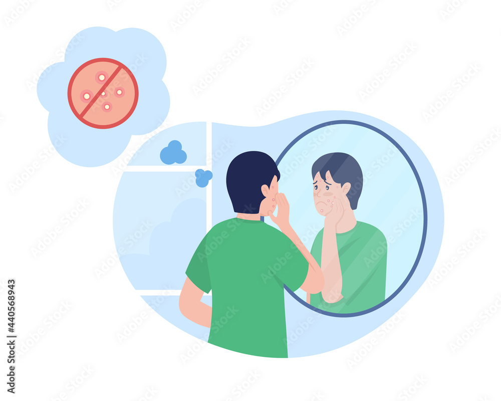 Teenage boy sad over pimple 2D vector isolated illustration. Skin care ...