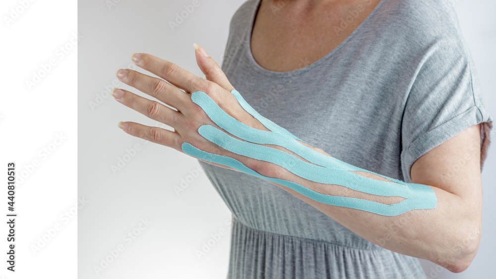 Female arm with blue medical moisture resistant elastic kinesio tape to ...