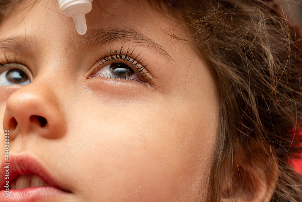 treatment, using therapeutic, medical eye drops for a child with ...
