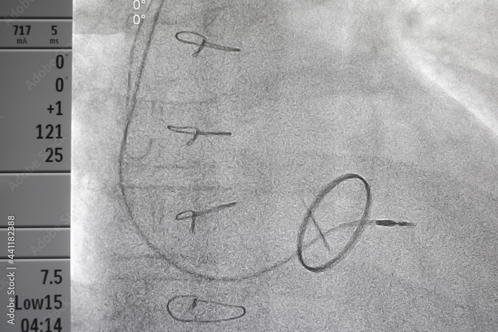 cardiac, heart, cardiology, vascular, cardiovascular, artery, health ...