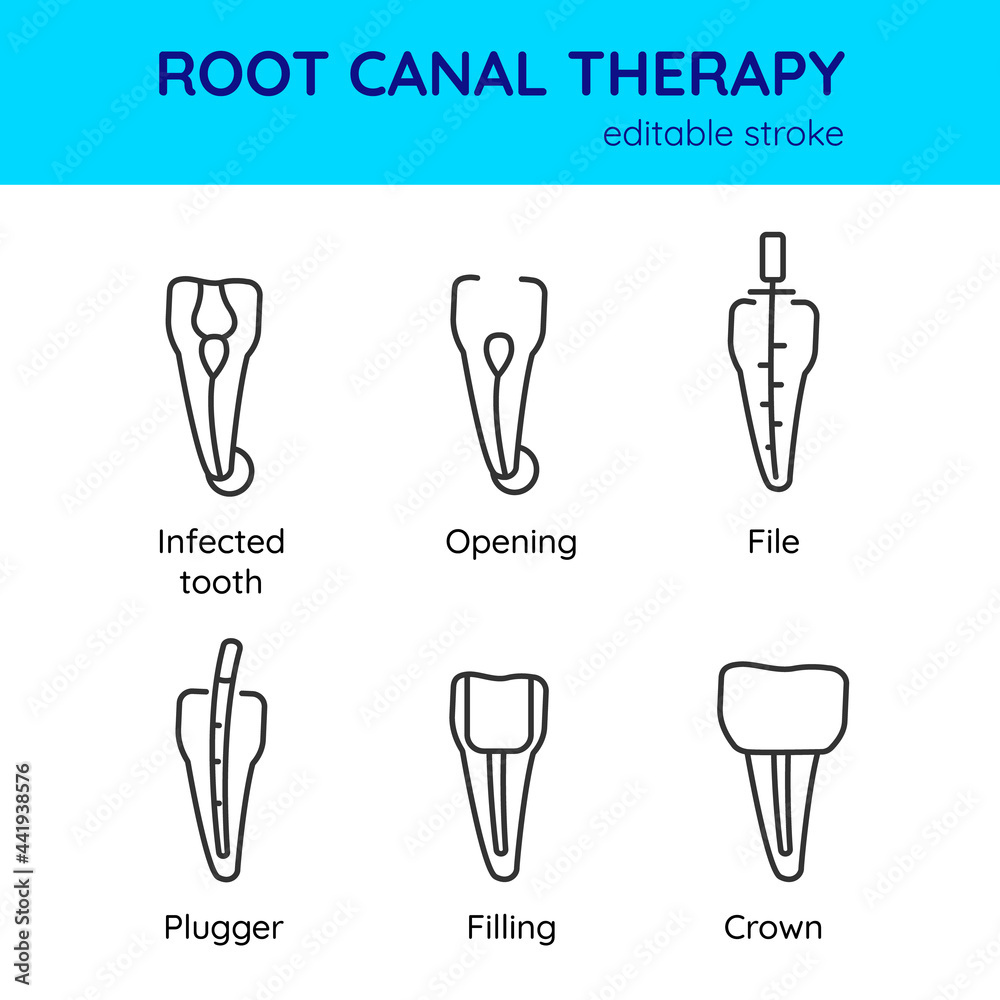 Root canal treatment linear icon set. Stages of tooth cleaning and ...