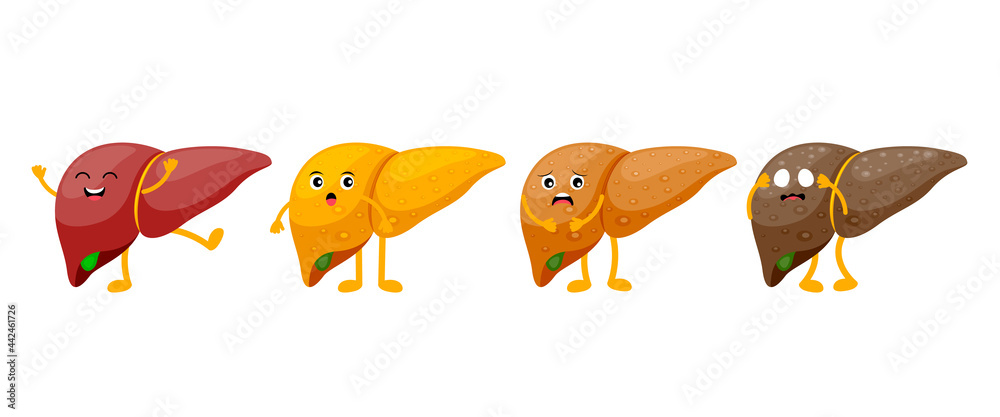 Stages of human liver damage. Liver cartoon character. Healthy, fatty ...