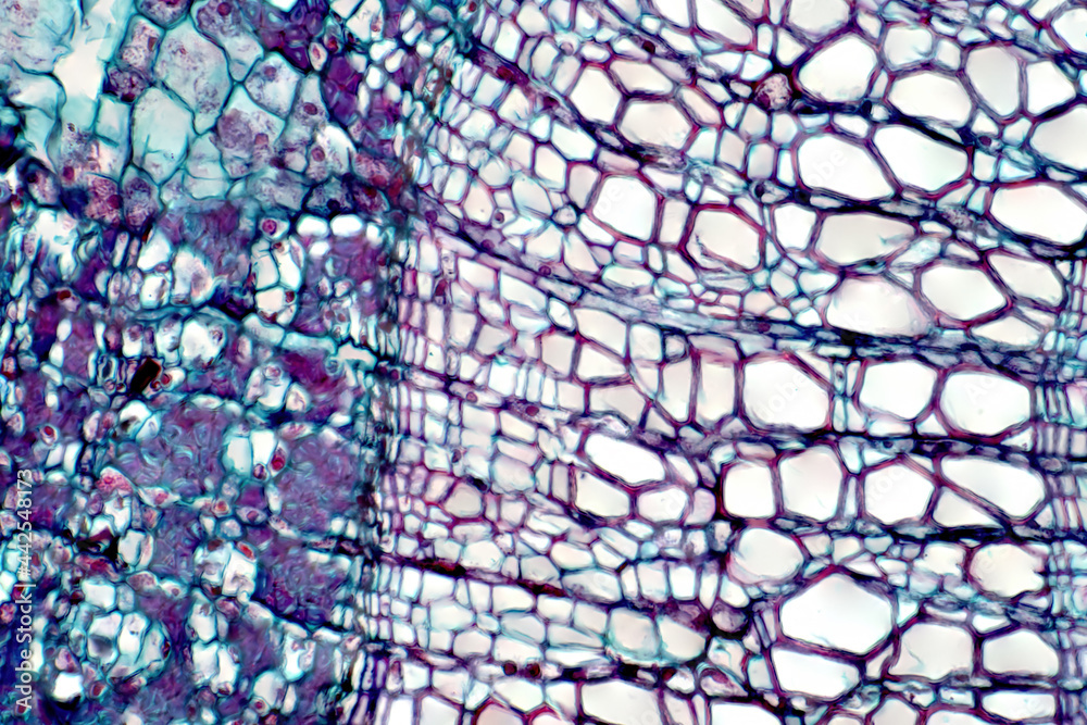 Cross section - Xylem is a type of tissue in vascular plants that ...