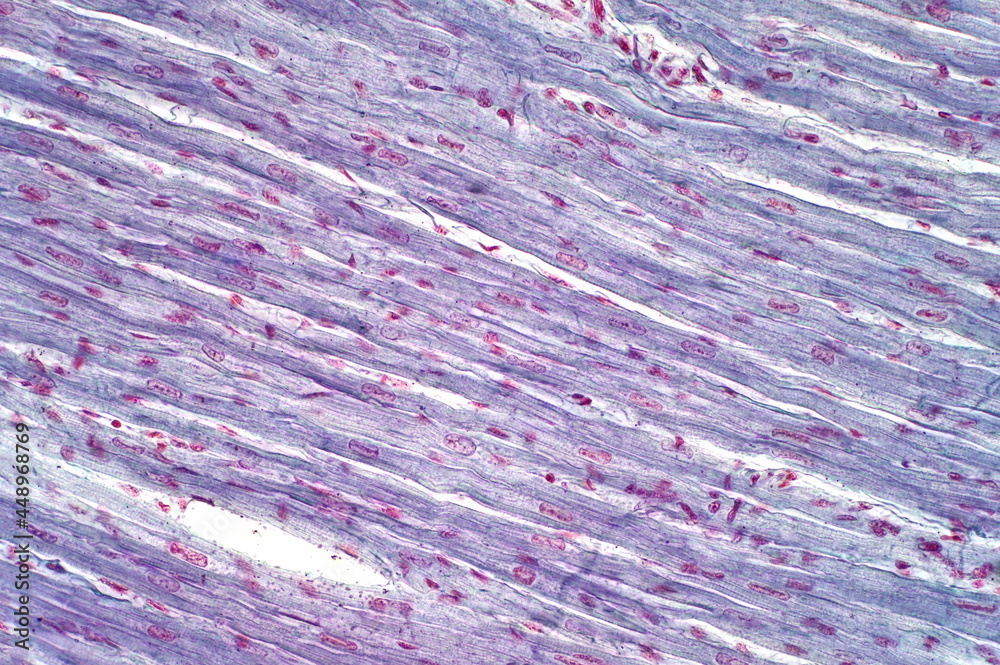 Histology of human cardiac muscle under light microscope view for ...