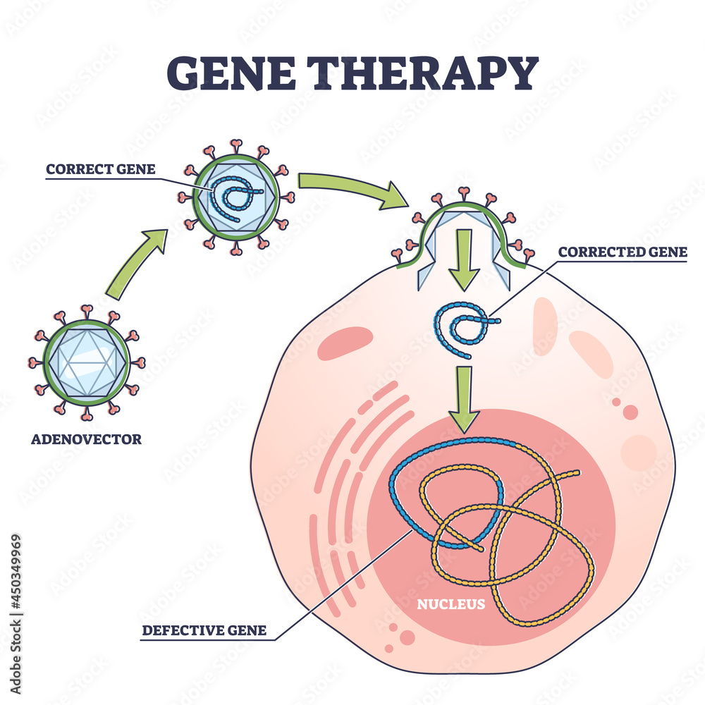 Gene therapy medical treatment and correct genome replacement outline ...