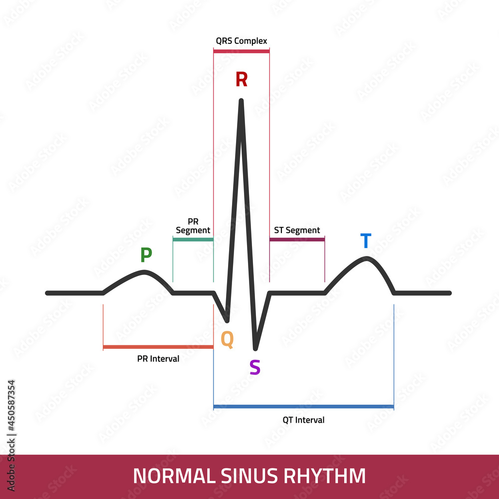 Image vectorielle Stock EKG showing normal heartbeat wave. ECG of ...
