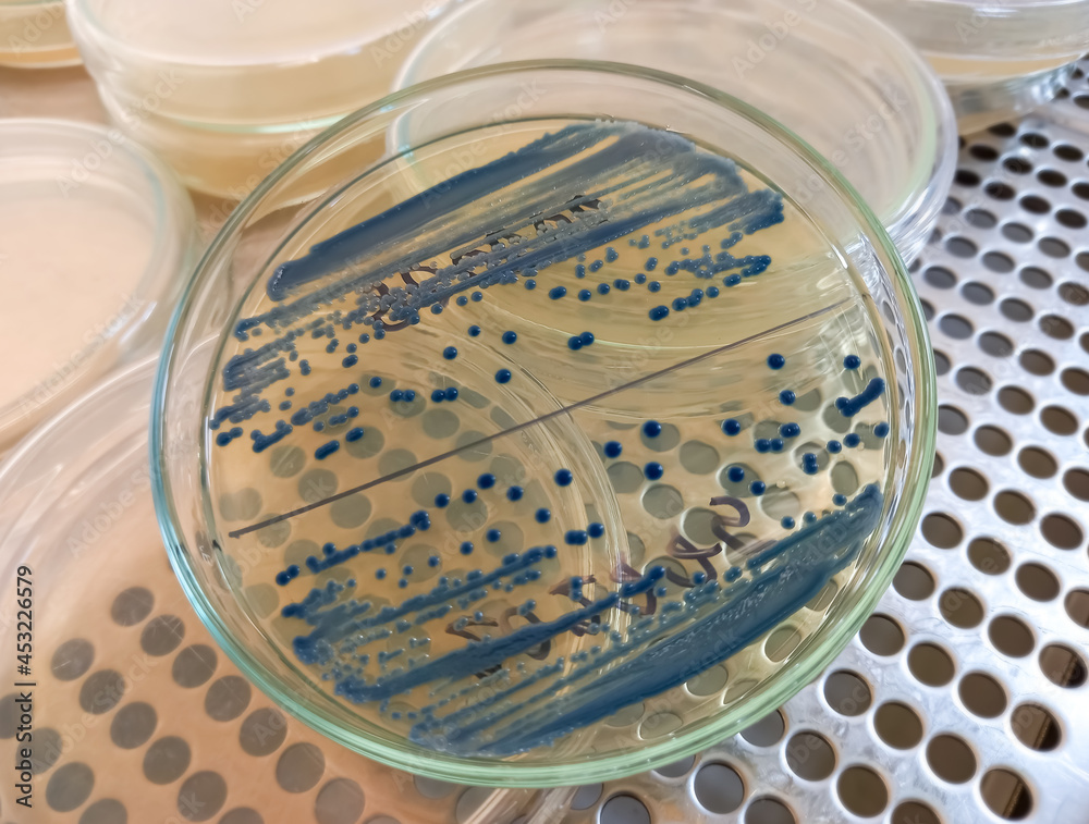 Enterobacter colonies, Gram negative bacilli colonies as test on ...