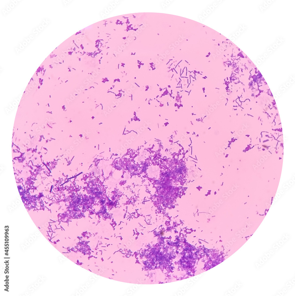 Urinary Tract Infection Bacteria Microscope