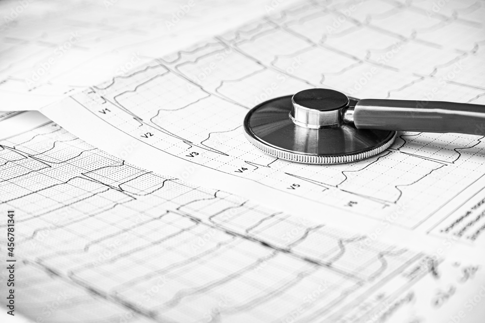 Stethoscope on the electrocardiogram (ECG) graph (top view). EKG ...