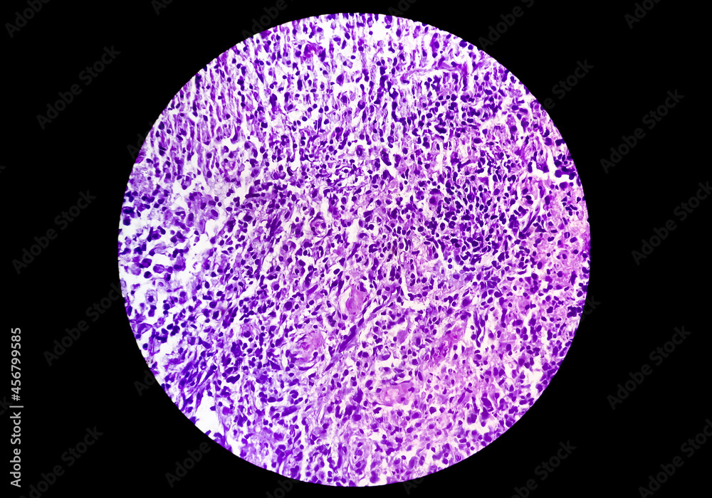 A histological slide of a tissue sample. Close microscopic view ...