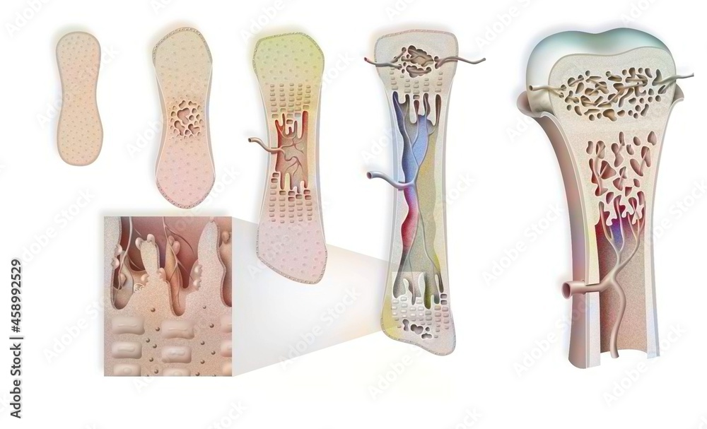 Development of bone (osteogenesis) from cartilage to adult bone. Stock ...
