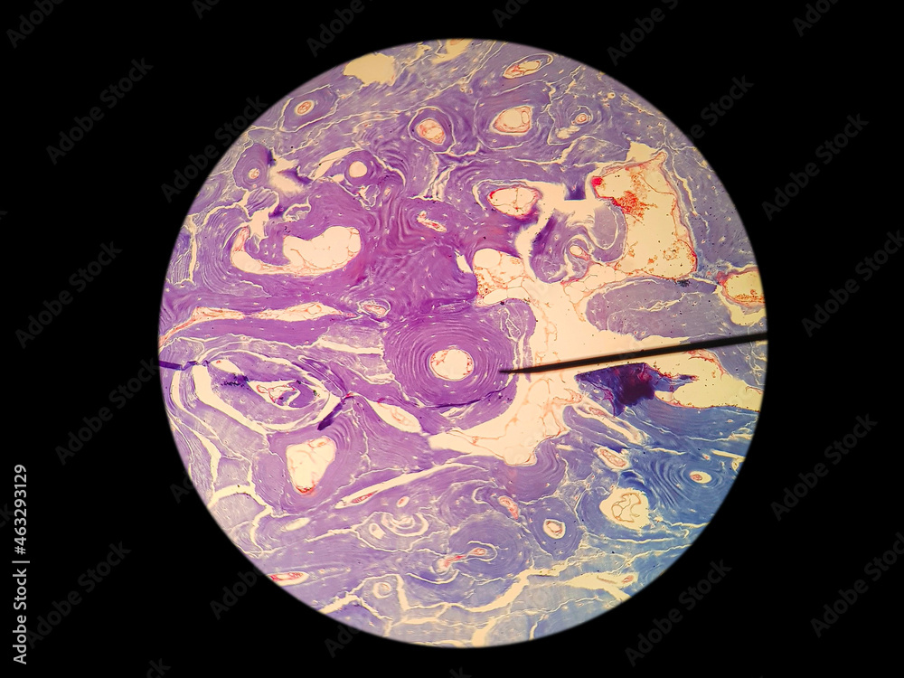 Histology of decalcified bone cross section Stock Photo | Adobe Stock