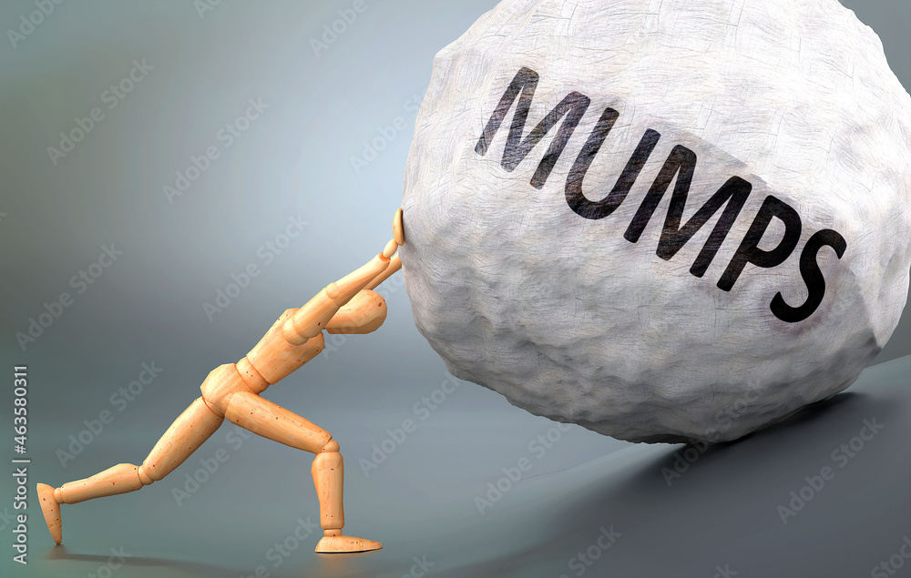 Mumps - depiction, impression and presentation of this condition shown ...