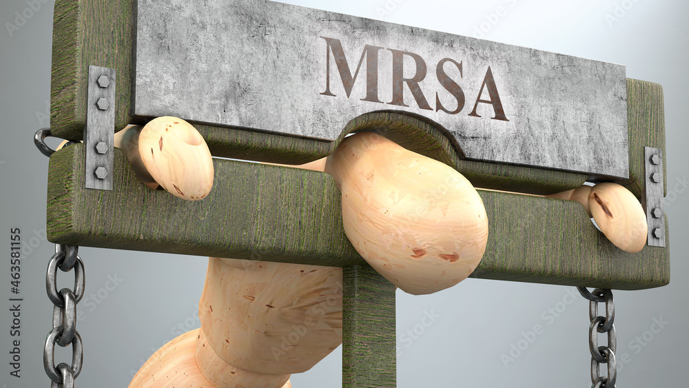 Mrsa impact and social influence shown as a figure in pillory to depict ...