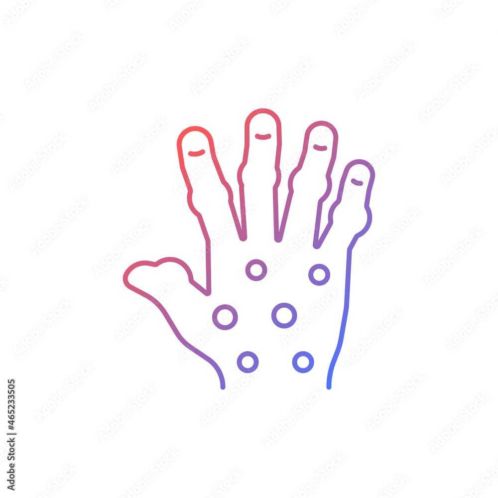 Psoriatic arthritis gradient linear vector icon. Painful hand joints ...