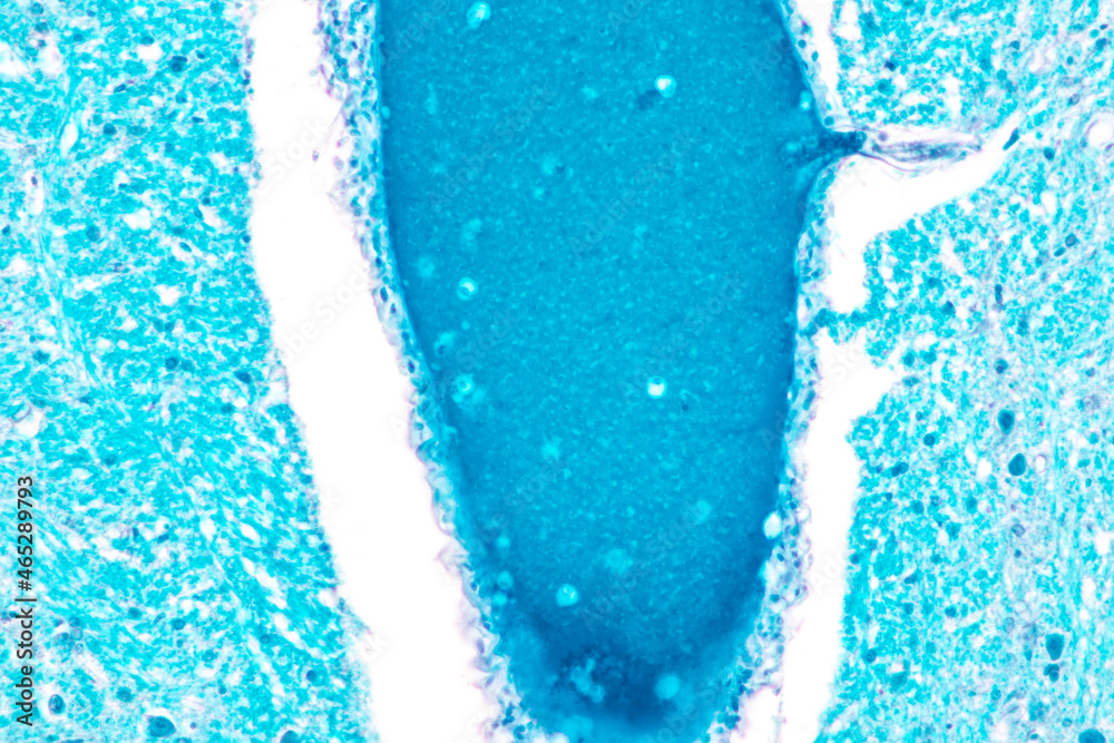 Foto de Stock Cerebellum, Thalamus, Medulla oblongata, Spinal cord and ...