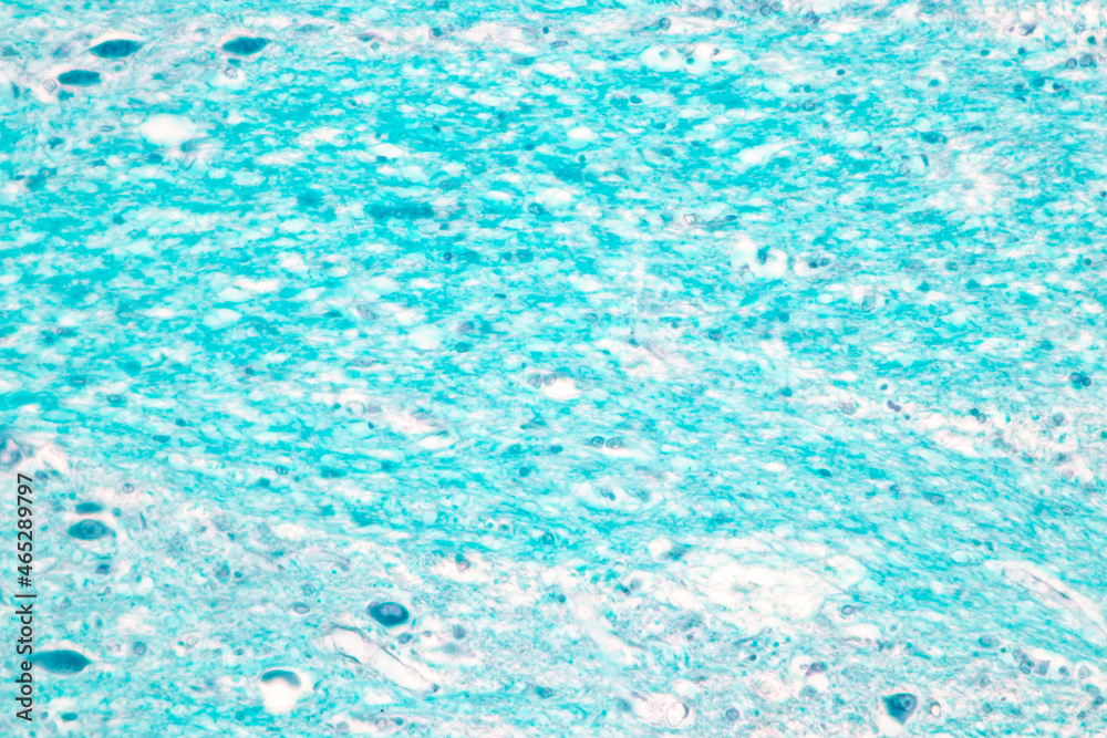 Foto de Stock Cerebellum, Thalamus, Medulla oblongata, Spinal cord and ...